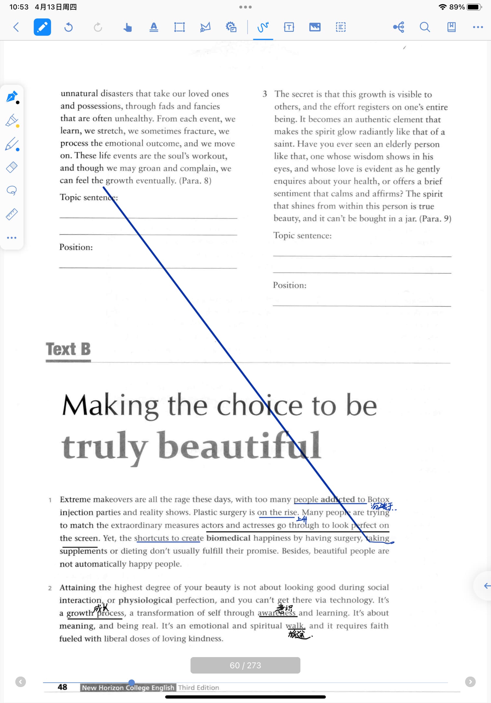 apple pencil写字时乱画 - iPadOS故障 - MarginNote 中文社区